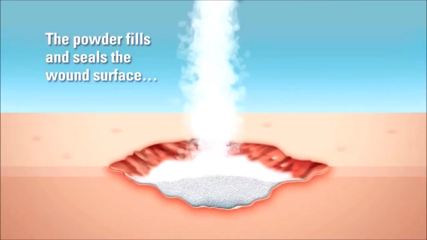 Mechanism of Transforming Powder Dressing for Wound Healing